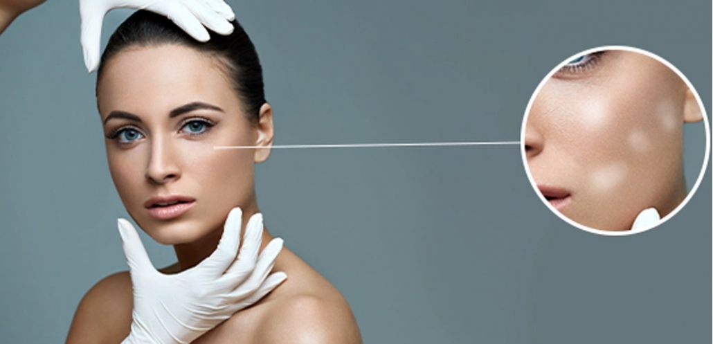 Macchie Bianche Sulla Pelle: Cause E Rimedi